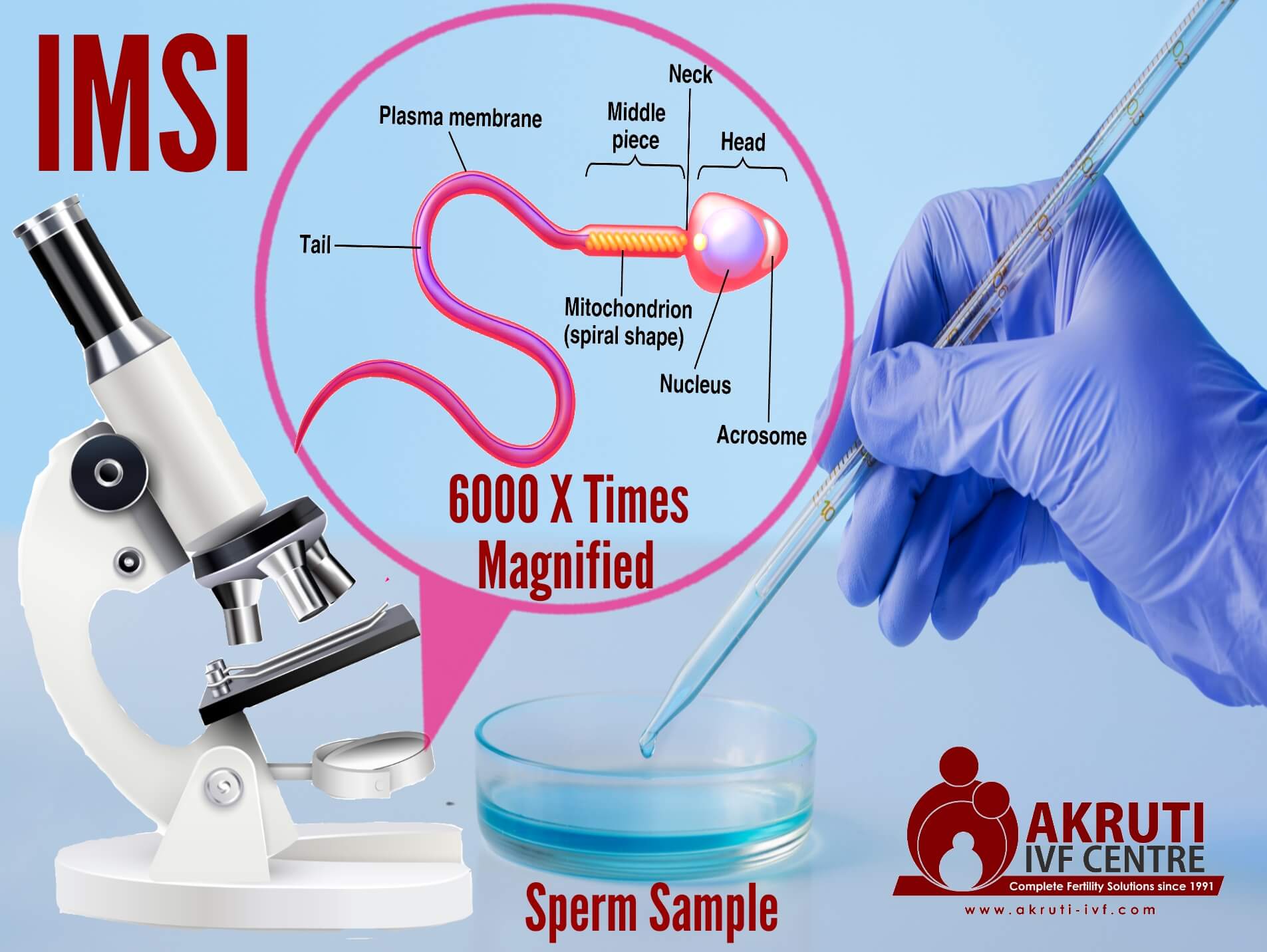 IMSI (Intracytoplasmic Morphologically Selected Sperm Injection ...