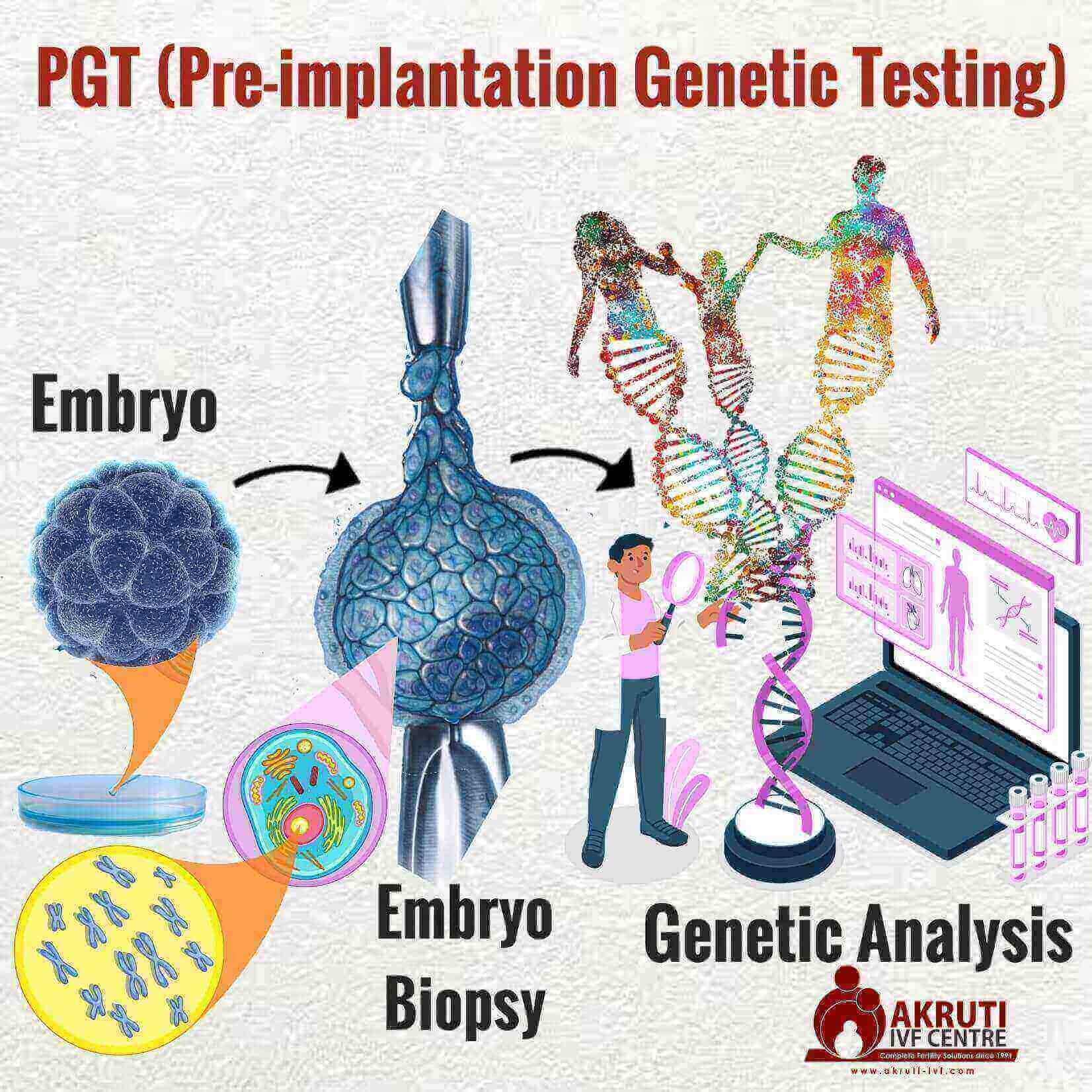 PGT Preimplantation Genetic Test for Best Embryo selection